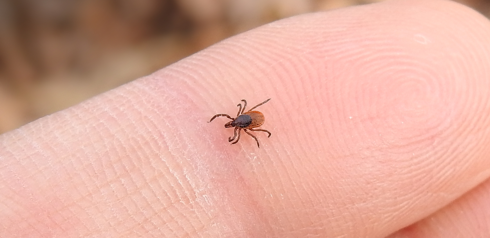 How Do I Deal With Ticks? - Learn Your Land